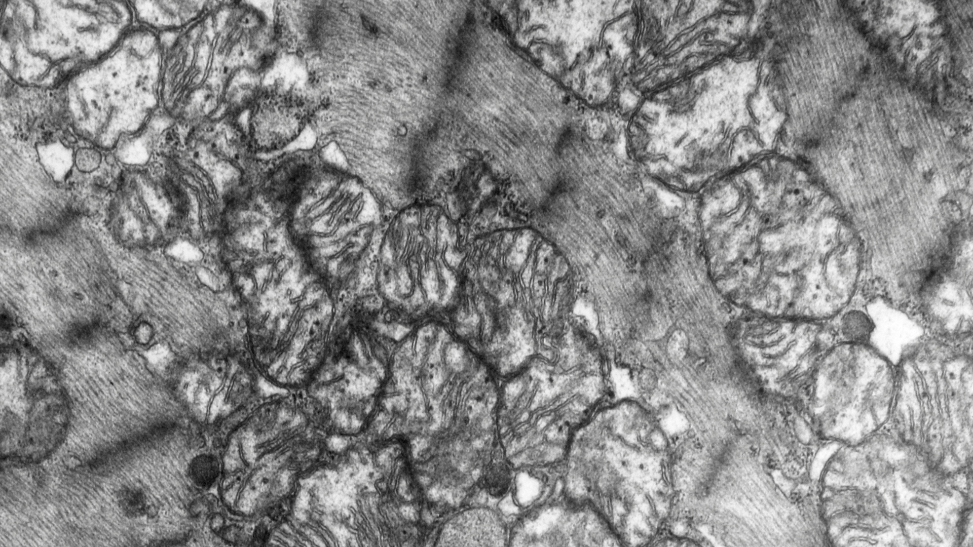 Mighty Mitochondria – The Body’s Master Regulators - Documenting Hope